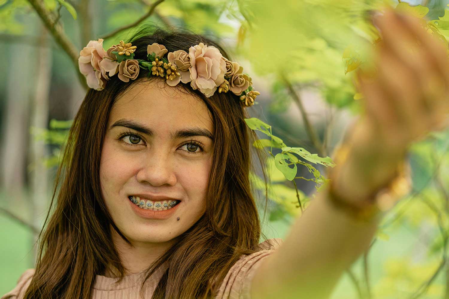 A Comprehensive Guide to Braces: Types, Care, Duration, and More ...